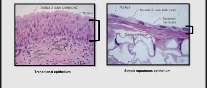 Solved study the different epithelial tissues presented. | Chegg.com