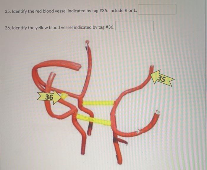 Solved 35. Identify the red blood vessel indicated by tag | Chegg.com