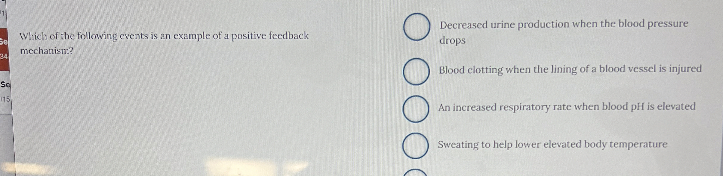 Solved Decreased urine production when the blood | Chegg.com