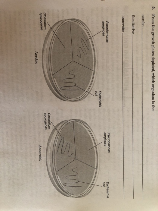 Solved 5. From the growth plates depicted, which organism is | Chegg.com