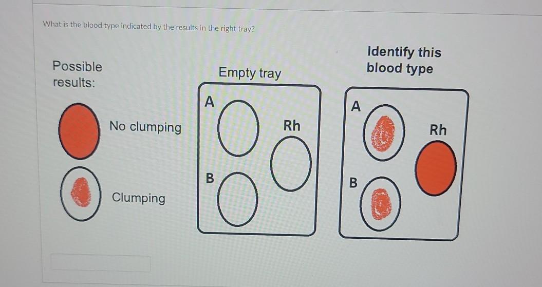 Solved What is the blood type indicated by the results in | Chegg.com