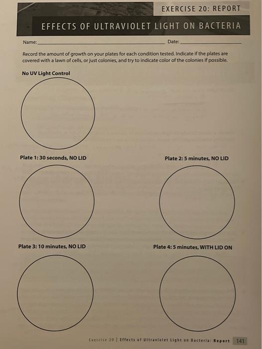 Solved EXERCISE 20: REPORT EFFECTS OF ULTRAVIOLET LIGHT ON | Chegg.com