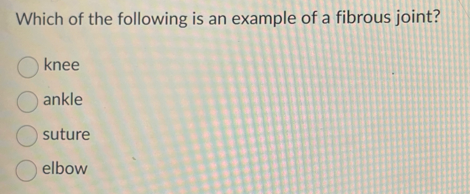 Solved Which of the following is an example of a fibrous | Chegg.com