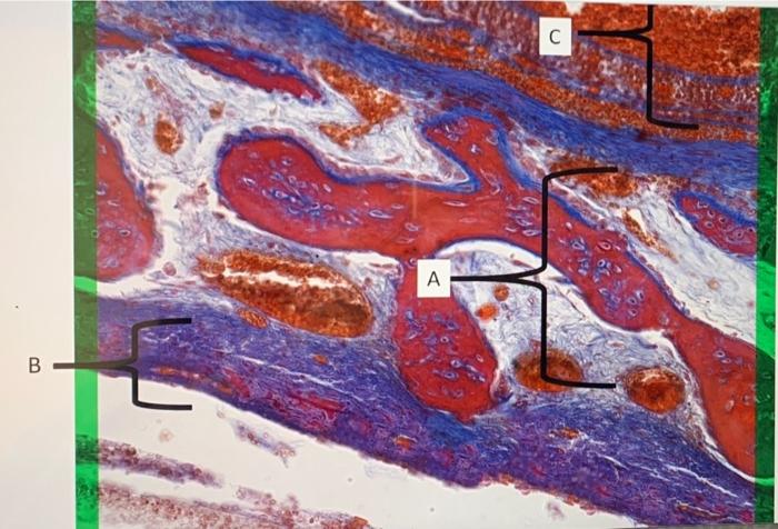 Solved с А. B V Area A is spongy bone Area B is the outer | Chegg.com