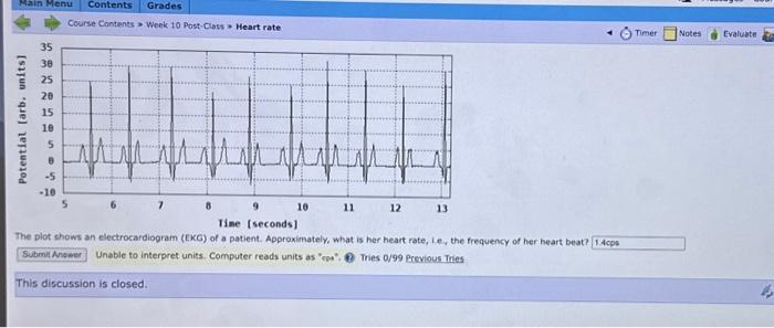 Solved The plot shows an electrocardiogram (EKG) of a | Chegg.com