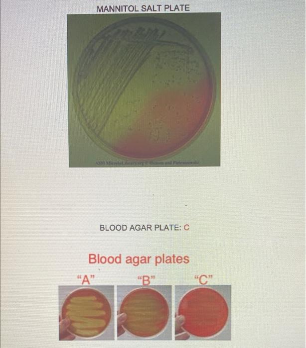 Solved MANNITOL SALT PLATE BLOOD AGAR PLATE: C Blood agar | Chegg.com
