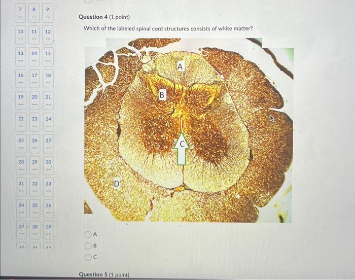 Solved Which of the labeled spinal cord structures consists | Chegg.com
