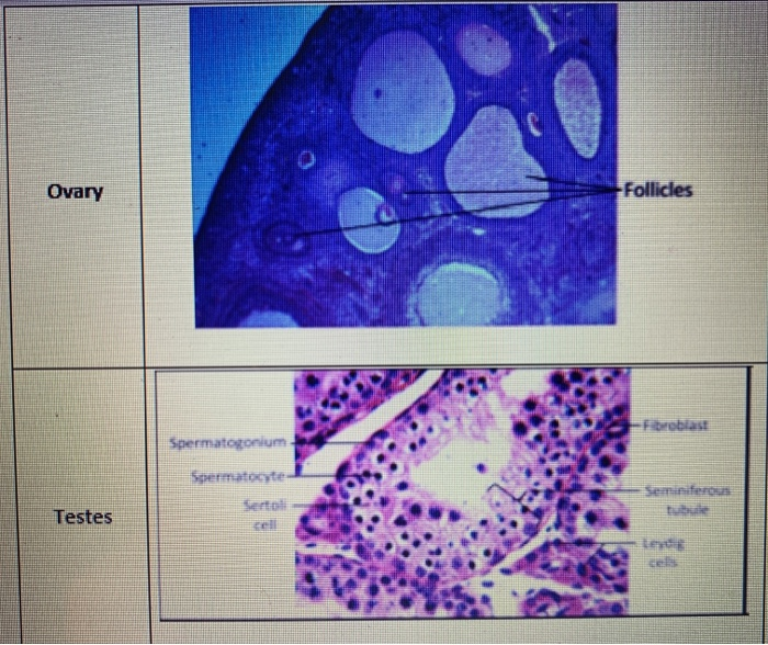 Solved Photo Acidophil cell Basophil cell Anterior pituitary | Chegg.com