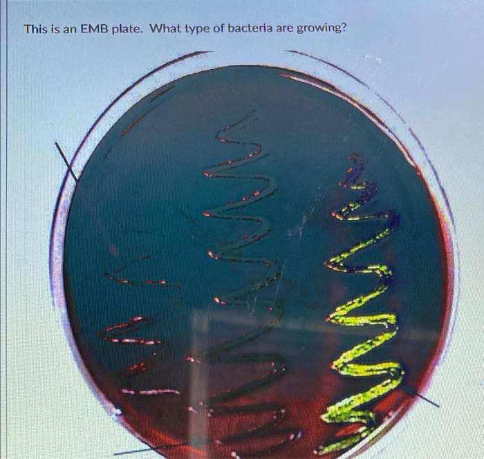 Solved This is an EMB plate. What type of bacteria are | Chegg.com