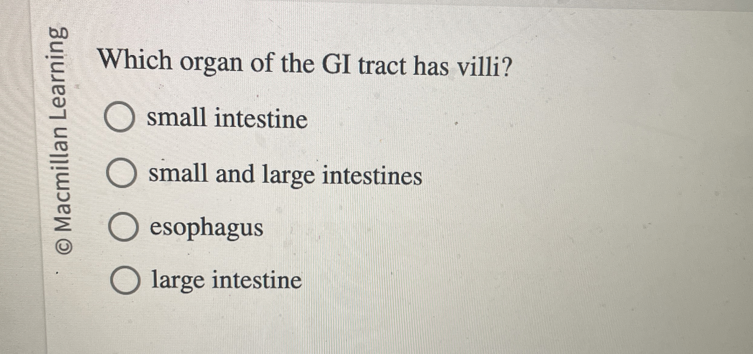 Solved Which organ of the GI tract has villi?small | Chegg.com
