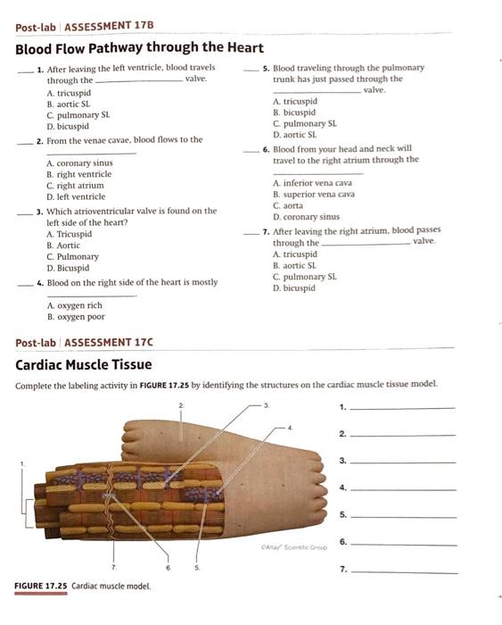 Solved Post-lab ASSESSMENT 17B Blood Flow Pathway through | Chegg.com