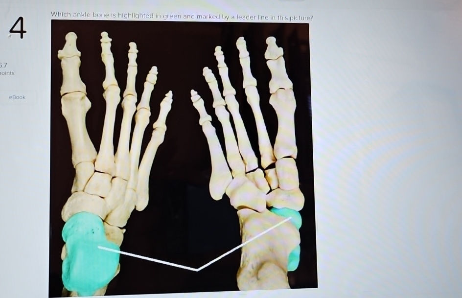 Solved 457ointseBookWhich ankle bone is highlighted in qreen | Chegg.com