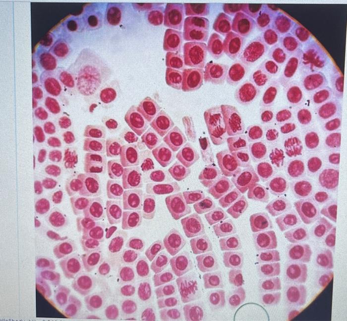 Solved on this onion root tip slide how many prophase, | Chegg.com