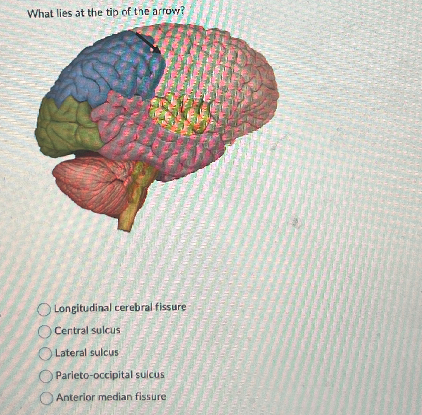 Solved What lies at the tip of the arrow?Longitudinal | Chegg.com