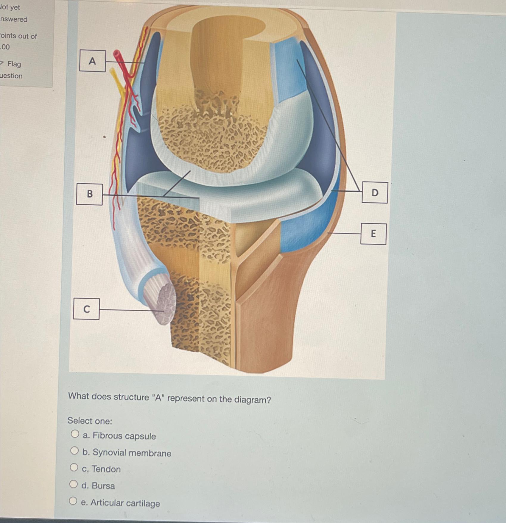 Solved What does structure "A" ﻿represent on the | Chegg.com