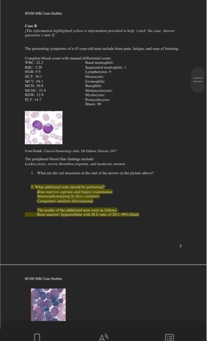 Solved BY330 WBC Case Studies Case A [The information | Chegg.com