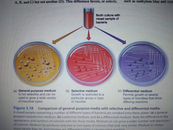 Solved Explain what a medium that is both selective and | Chegg.com