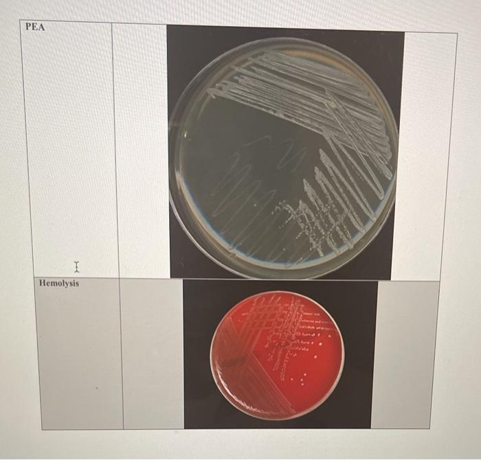 Solved Part 2: Media and Biochemical Tests For Gram Positive | Chegg.com