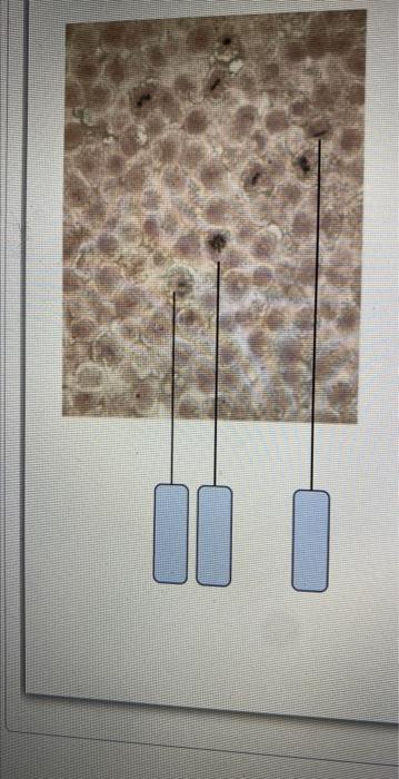 Complete the labeling activity by identifying each | Chegg.com