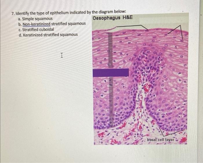 Solved 1. Identify the type of epithelium indicated by the | Chegg.com