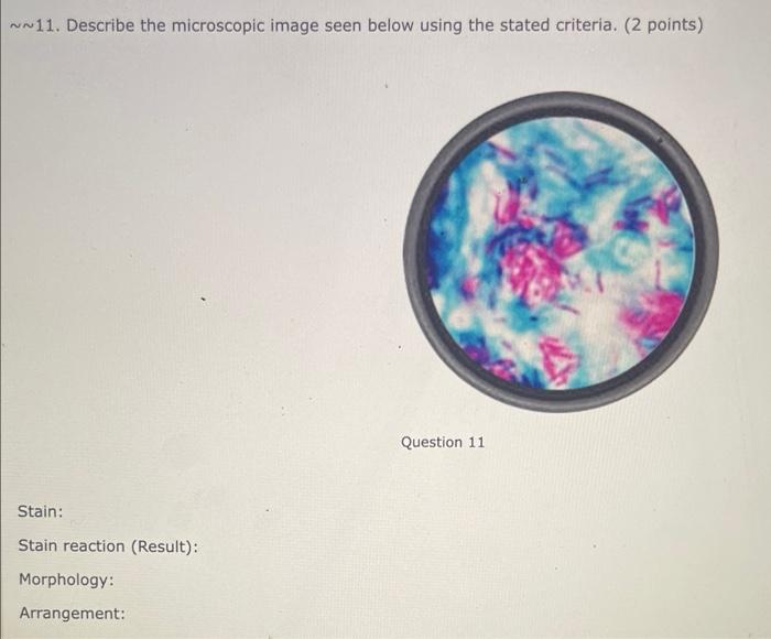 11. Describe the microscopic image seen below using | Chegg.com