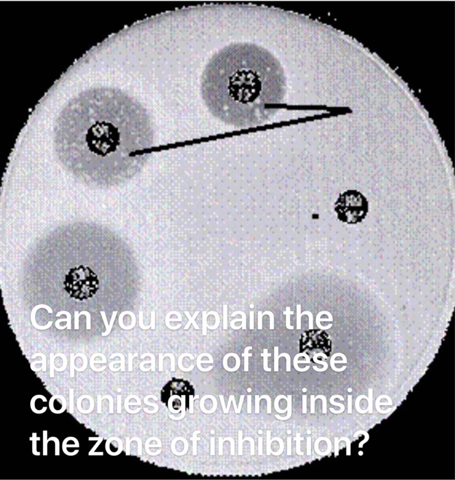 Solved Can you explain the appearance of these colonies | Chegg.com