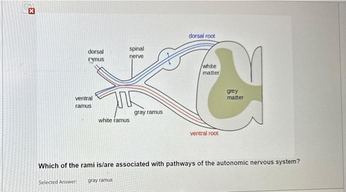 Solved Which of the rami is/are associated with pathways of | Chegg.com