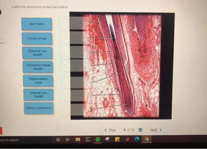 Solved Label the structures of the hair follicle. Hair | Chegg.com