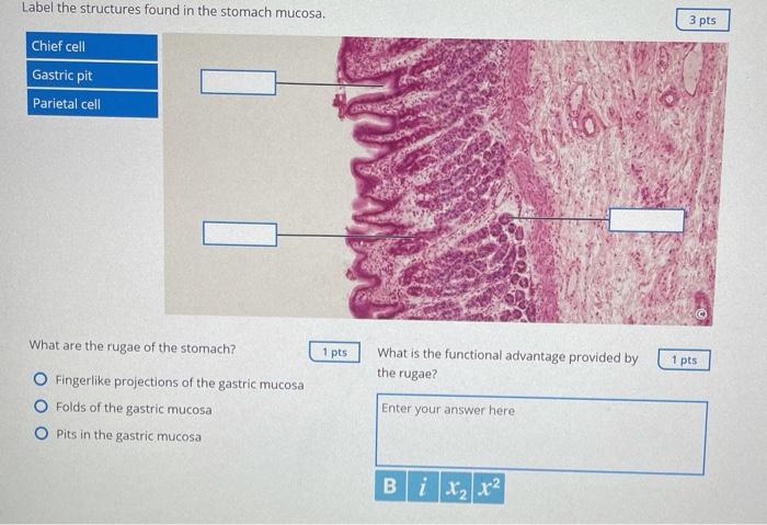 Solved Label the structures found in the stomach mucosa. 3 | Chegg.com