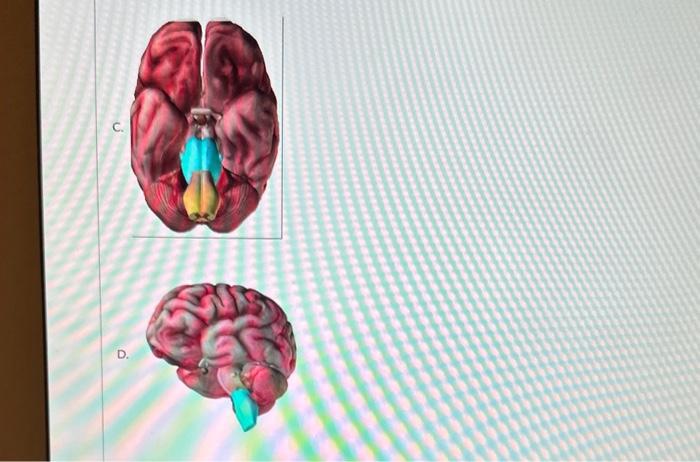 Solved This region of the brain regulates heart rate and | Chegg.com