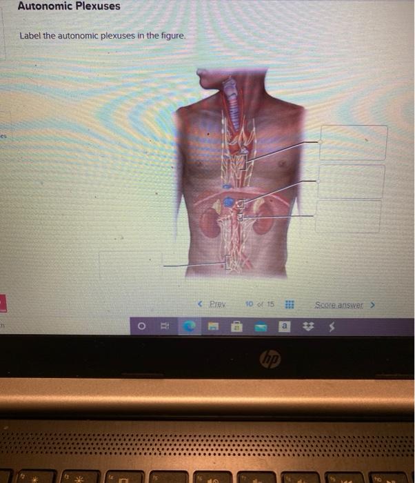 Solved Autonomic Plexuses Label the autonomic plexuses in | Chegg.com