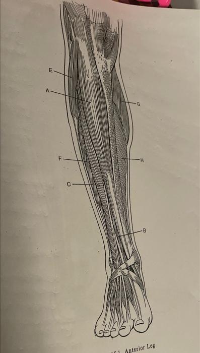 Solved A B Apterior Leg | Chegg.com