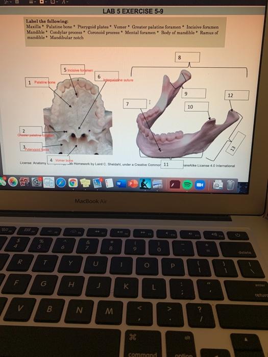 Solved LAB 5 EXERCISE 5-9 Label the following: Maxilla. | Chegg.com