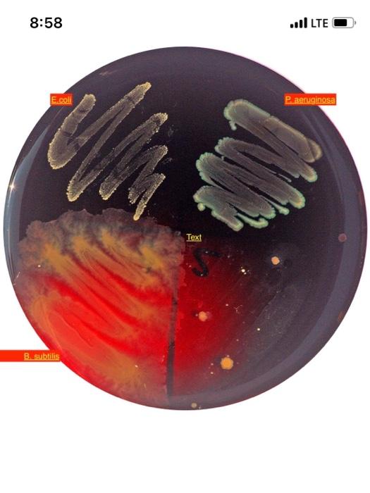 Starch plate - Data 8:58 -IIl LTE | Chegg.com