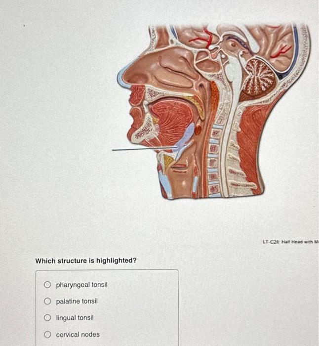 Solved Which structure is highlighted? O pharyngeal tonsil O | Chegg.com