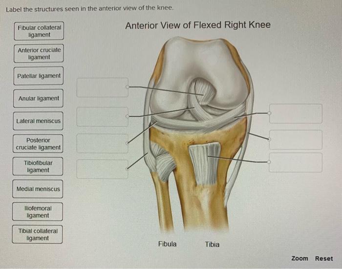 Solved Label the structures seen in the anterior view of the | Chegg.com