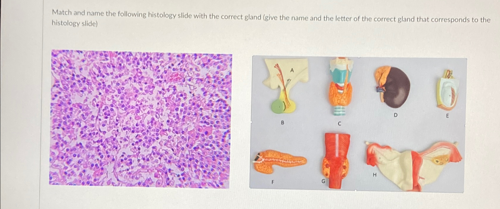 Solved Match and name the following histology slide with the | Chegg.com