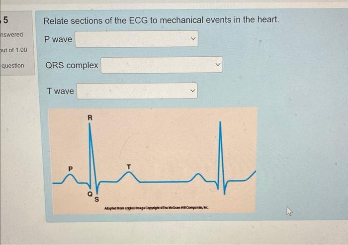 Solved Relate sections of the ECG to mechanical events in | Chegg.com