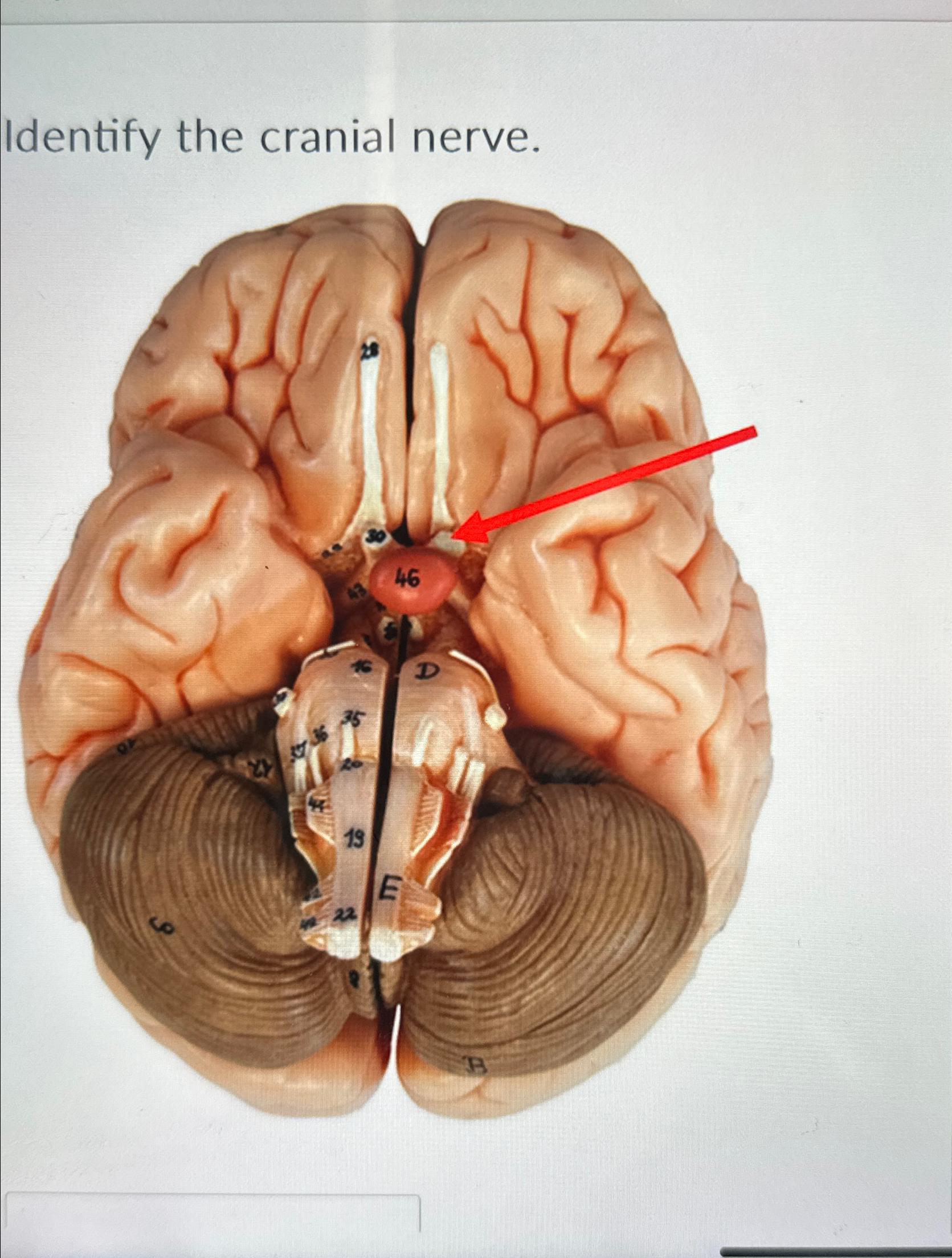 Solved Identify the cranial nerve. | Chegg.com
