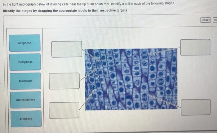 Solved Group 2 Cytokinesis Group 2 D Anaphase Group 1 | Chegg.com
