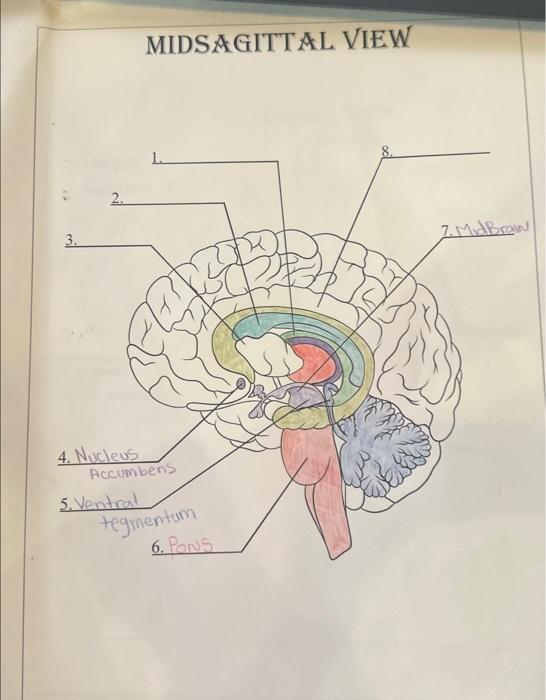 Solved MIDSAGITTAL VIEW Caudate Cingulate cortex Fornix | Chegg.com