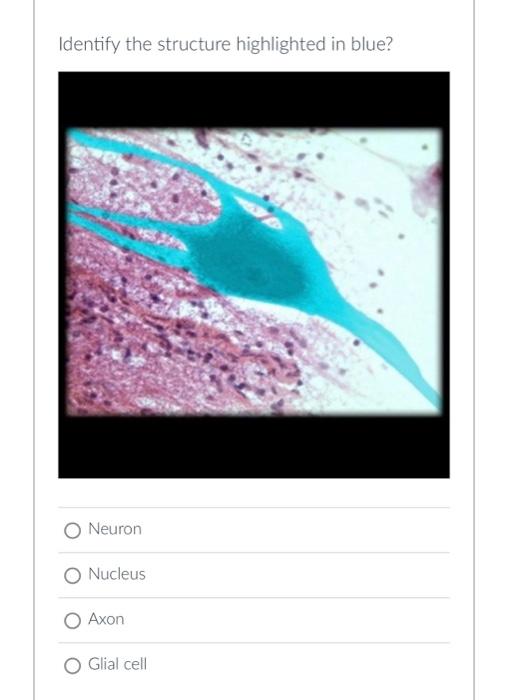 Solved Identify the structure highlighted in blue? Neuron | Chegg.com