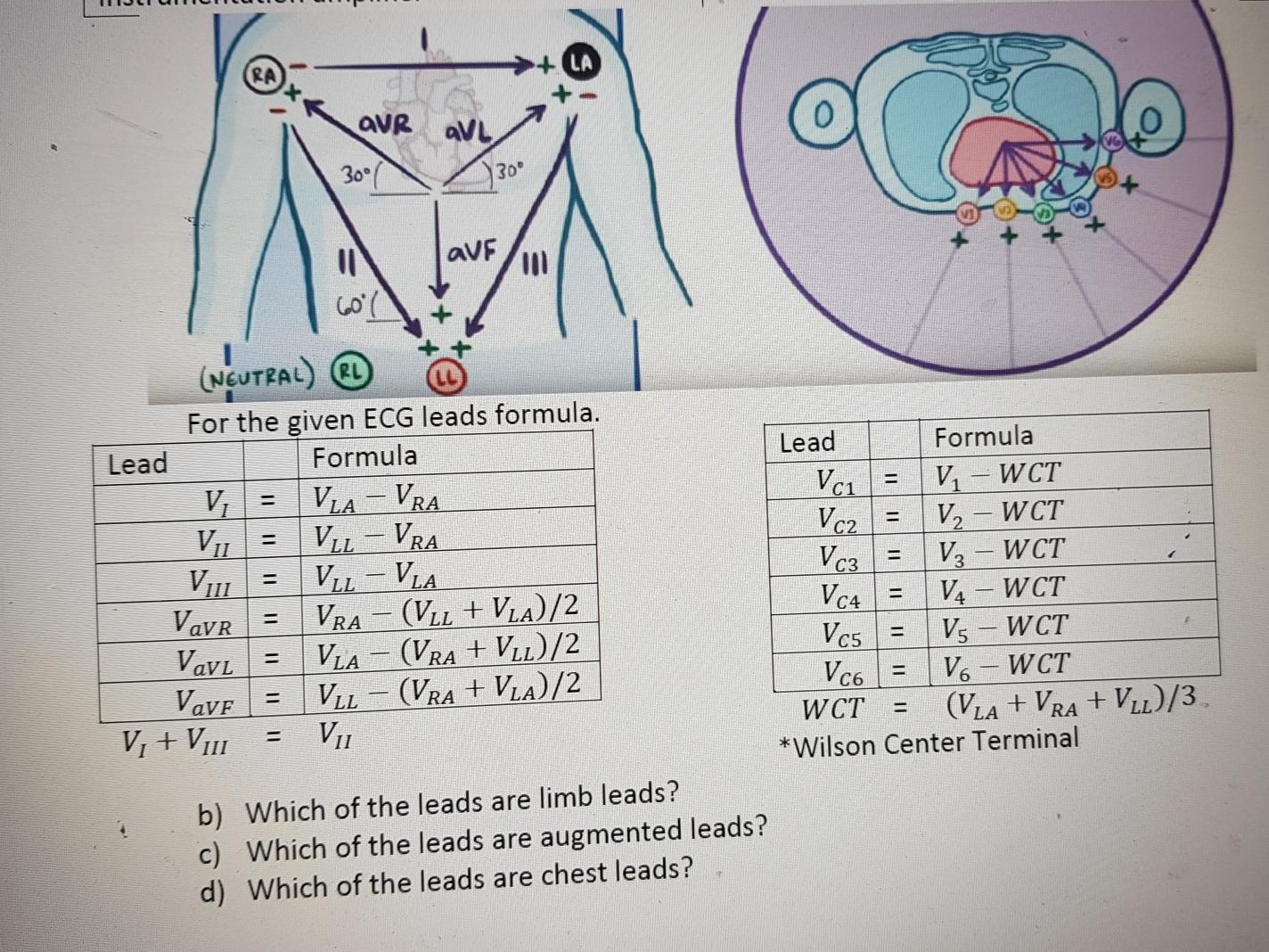 Solved AVR al 30° 30° aVF 60l V111 11 (NEUTRAL) RL For the | Chegg.com