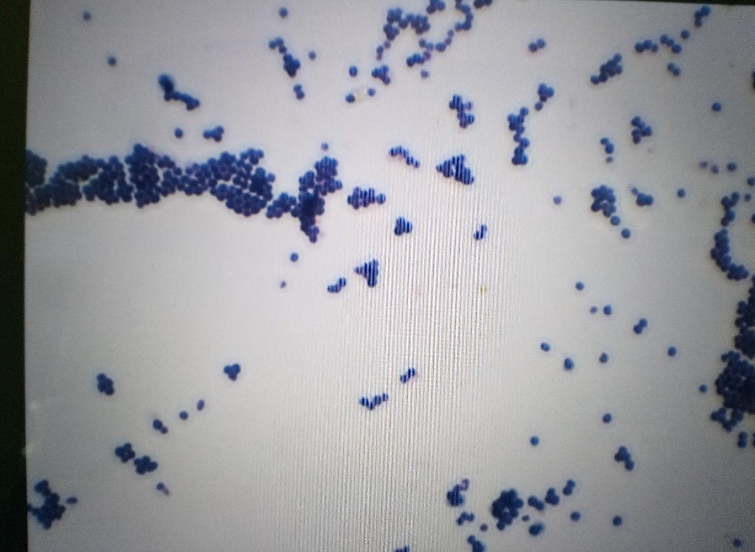 Solved Alcaligenes viscolactis Bacillus | Chegg.com