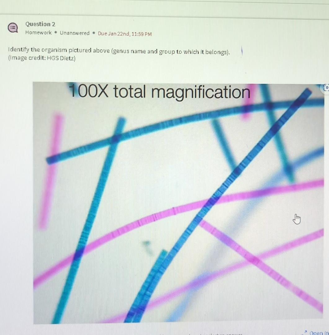 Solved 100× ﻿total magnification | Chegg.com