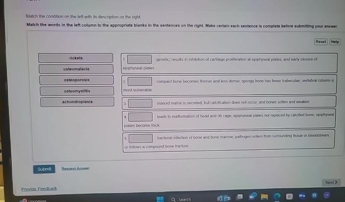 Solved Watch the condition on the lett with its description | Chegg.com