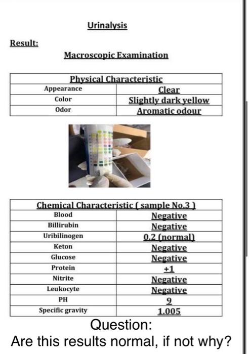 Solved Urinalysis Result: Macroscopic Examination Physical | Chegg.com