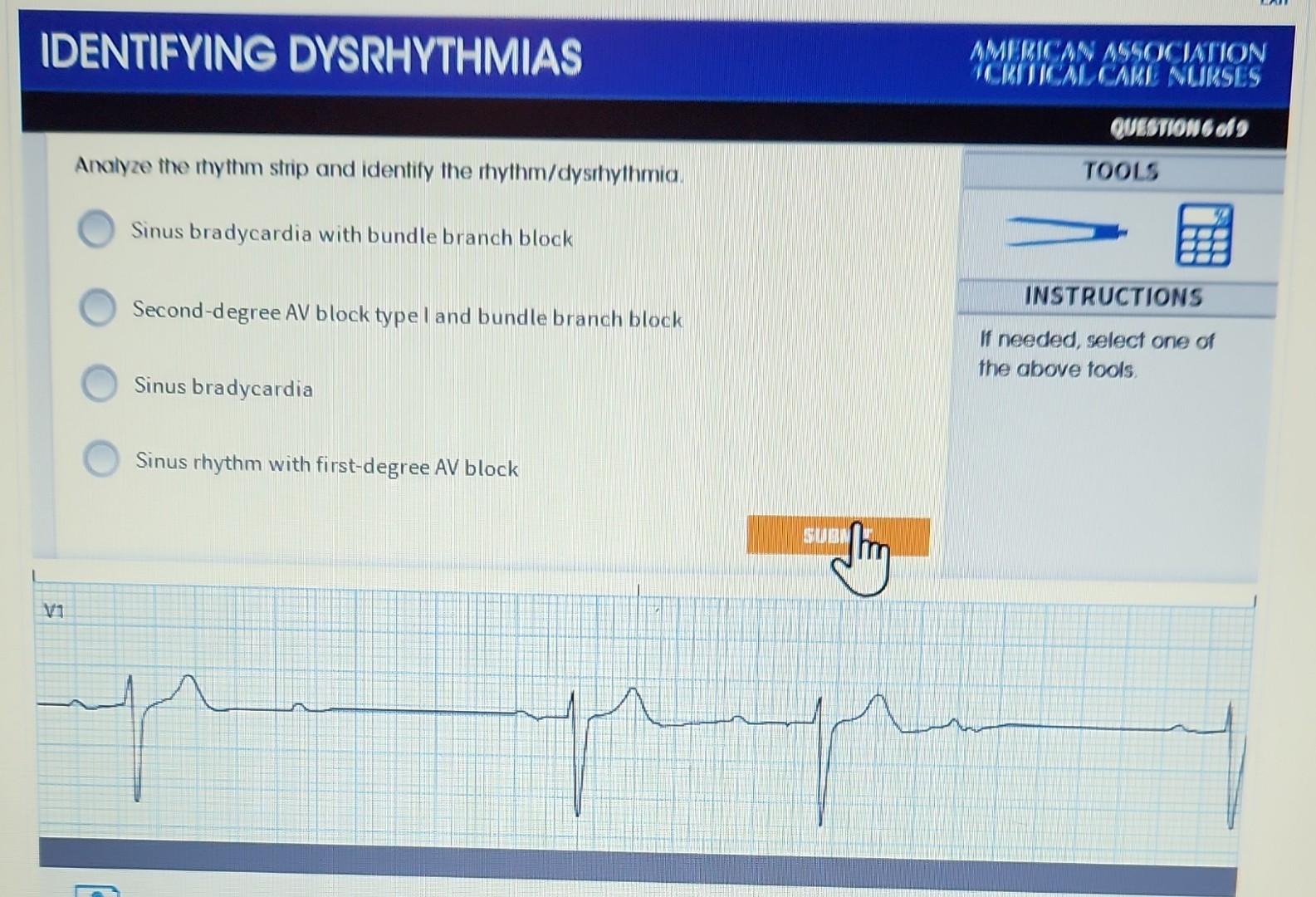 Solved Anclyze the ihythm strip and identify the | Chegg.com