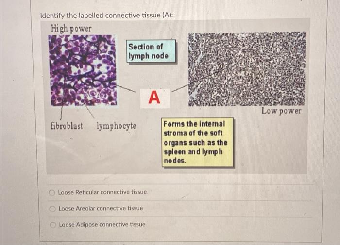 Solved Identify the labelled connective tissue (A): Loose | Chegg.com