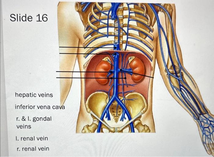 Solved r. renal vein | Chegg.com